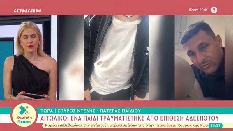 Συγκλονίζει ο πατέρας του παιδιού που δέχθηκε επίθεση από αδέσποτο στο ...